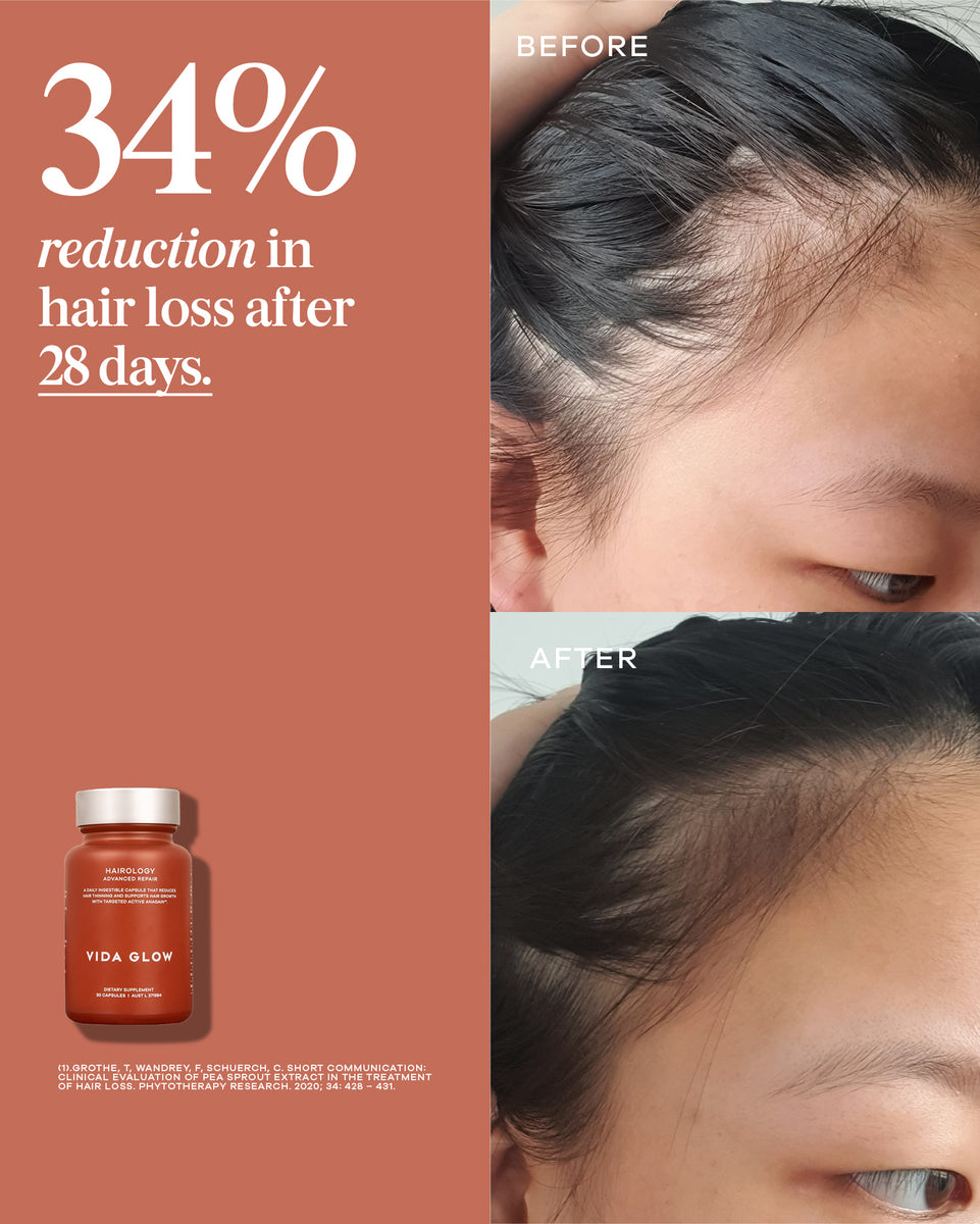 Hairology Capsules - Hair Growth Tablets | Vida Glow AU & NZ