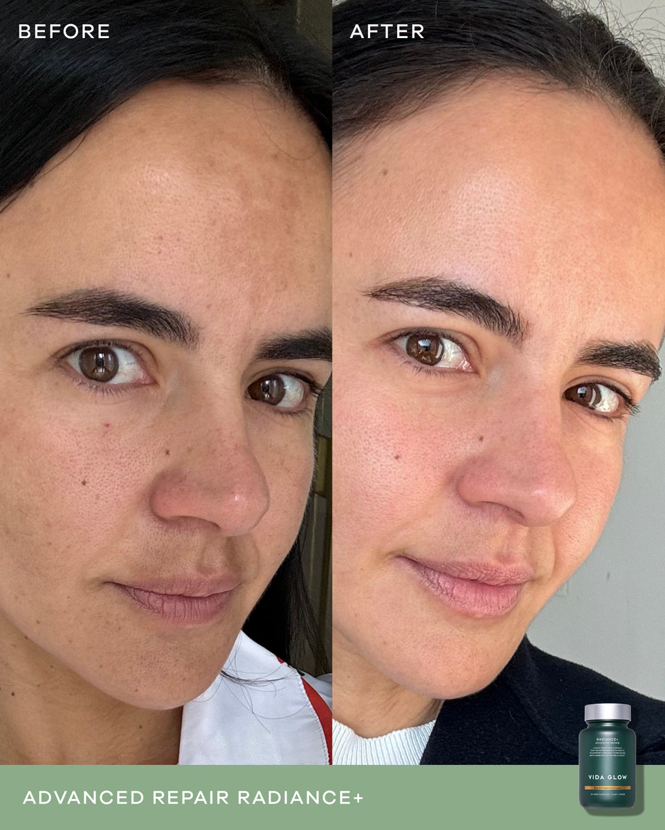 Radiance+ Capsules - Supplements for Radiant Skin | Vida Glow Au & NZ